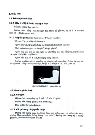 SGK Gãy hai xương cẳng tay Y4.pdf rất hay | PDF