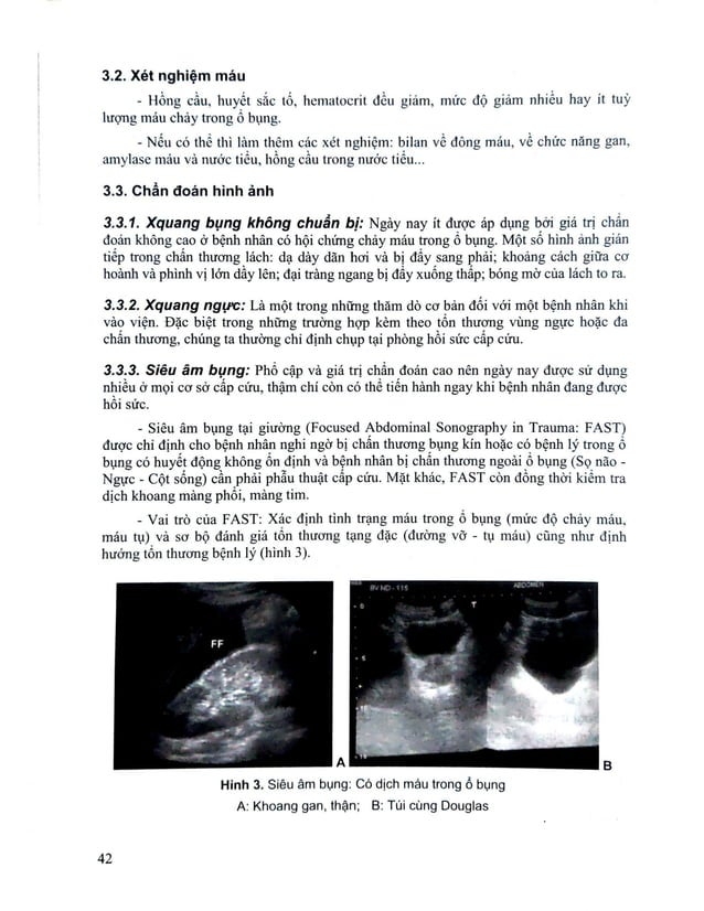 SGK Hội chứng chảy máu trong ổ bụng Y6.pdf