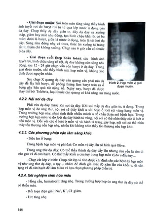 SGK Hẹp môn vị Y4.pdf rất hay nha các bạn | PDF