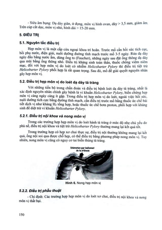 SGK Hẹp môn vị Y4.pdf rất hay nha các bạn | PDF