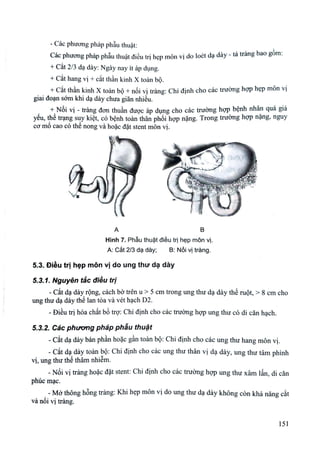 SGK Hẹp môn vị Y4.pdf rất hay nha các bạn | PDF