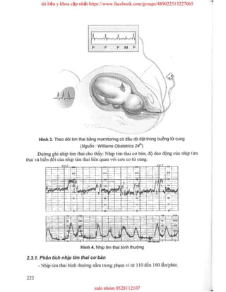 SGK mới suy thai cấp.pdf rất hay nha các bạn | PDF
