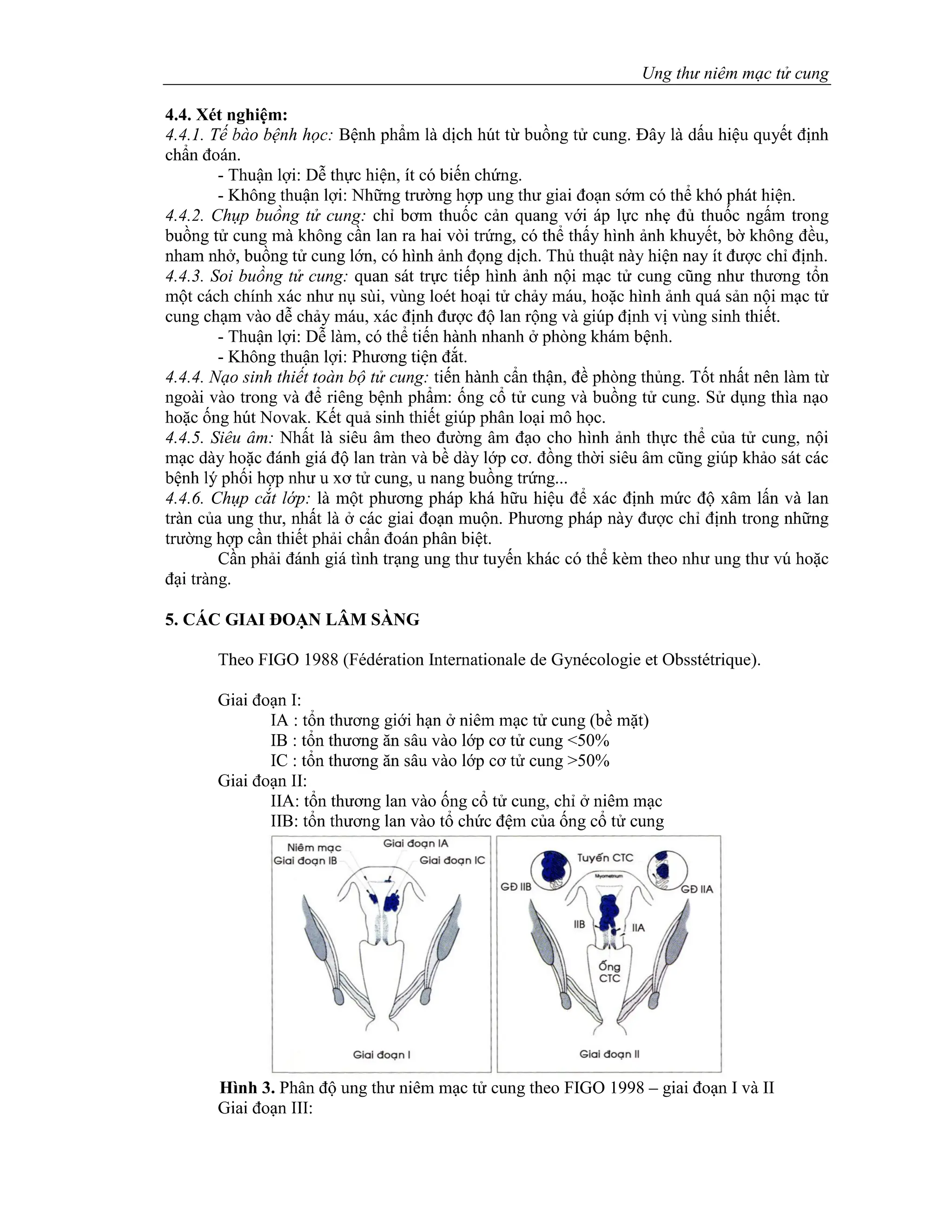 SGK sản Huế ung thư niêm mạc tử cung.pdf