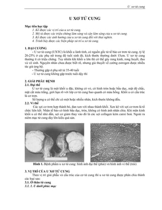 SGK sản huế u xơ tử cung.pdf hay khỏi phải bàn | PDF