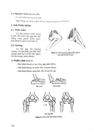 SGK Trật khớp khuỷu Y4.pdf hay các bạn ạ | PDF