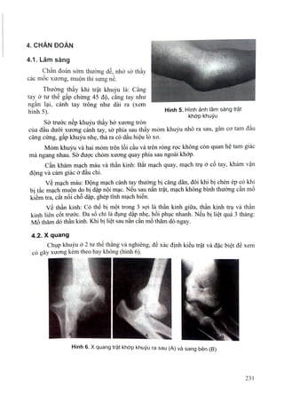 SGK Trật khớp khuỷu Y4.pdf hay các bạn ạ | PDF