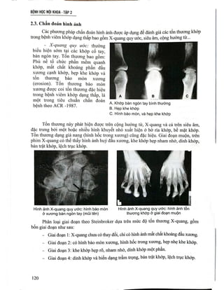 SGK VIÊM KHỚP DẠNG THẤP YHN .pdf