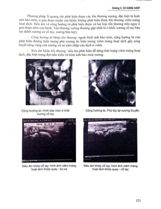 SGK VIÊM KHỚP DẠNG THẤP YHN .pdf