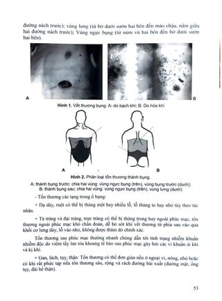 SGK Vết thương bụng Y4.pdf rất hay luôn nha bro | PDF