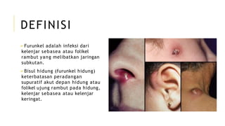 SGL-FRUNKEL PADA HIDUNG.pptx