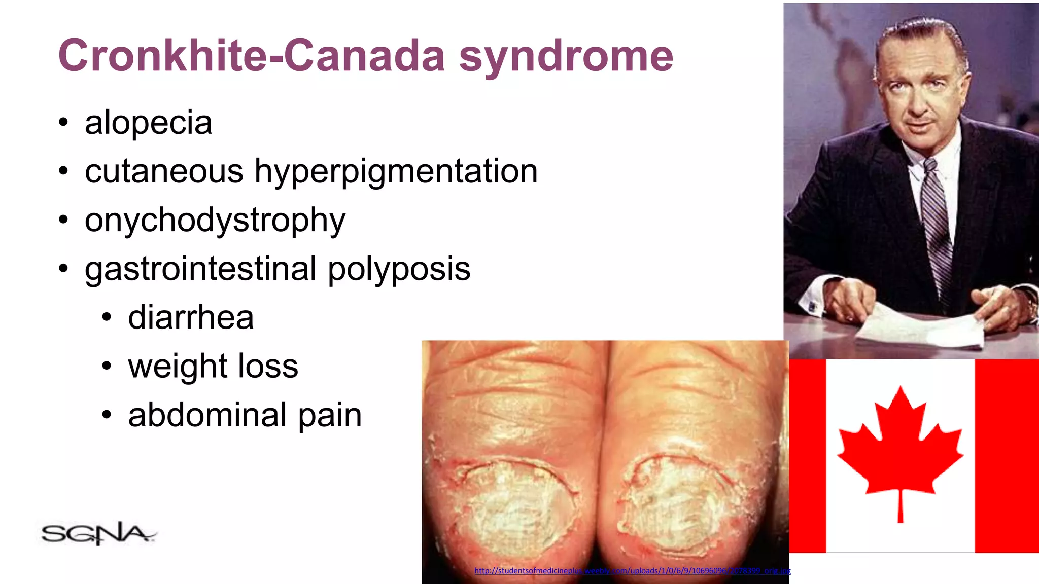 Know GI Inside & Out? Recognizing Skin Lesions of GI Disorders | PPTX