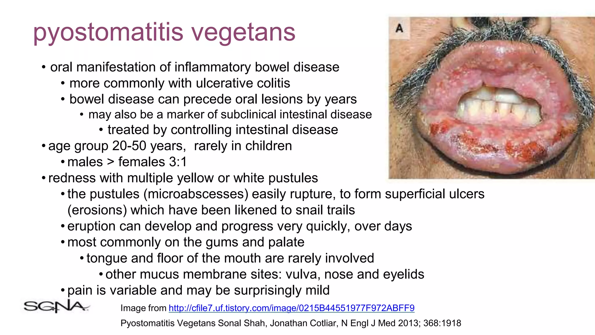 Know GI Inside & Out? Recognizing Skin Lesions of GI Disorders | PPTX
