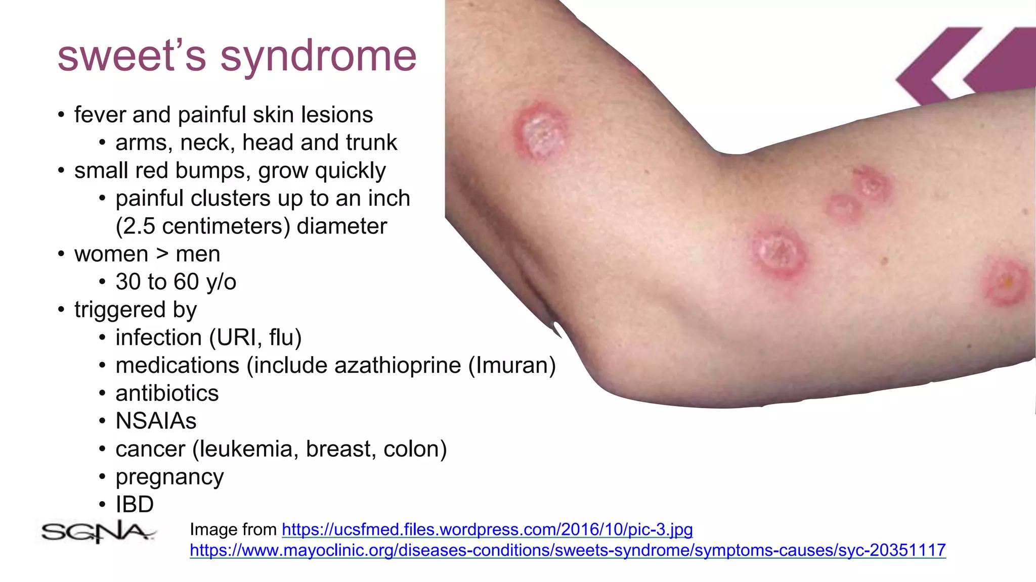 Know GI Inside & Out? Recognizing Skin Lesions of GI Disorders | PPTX