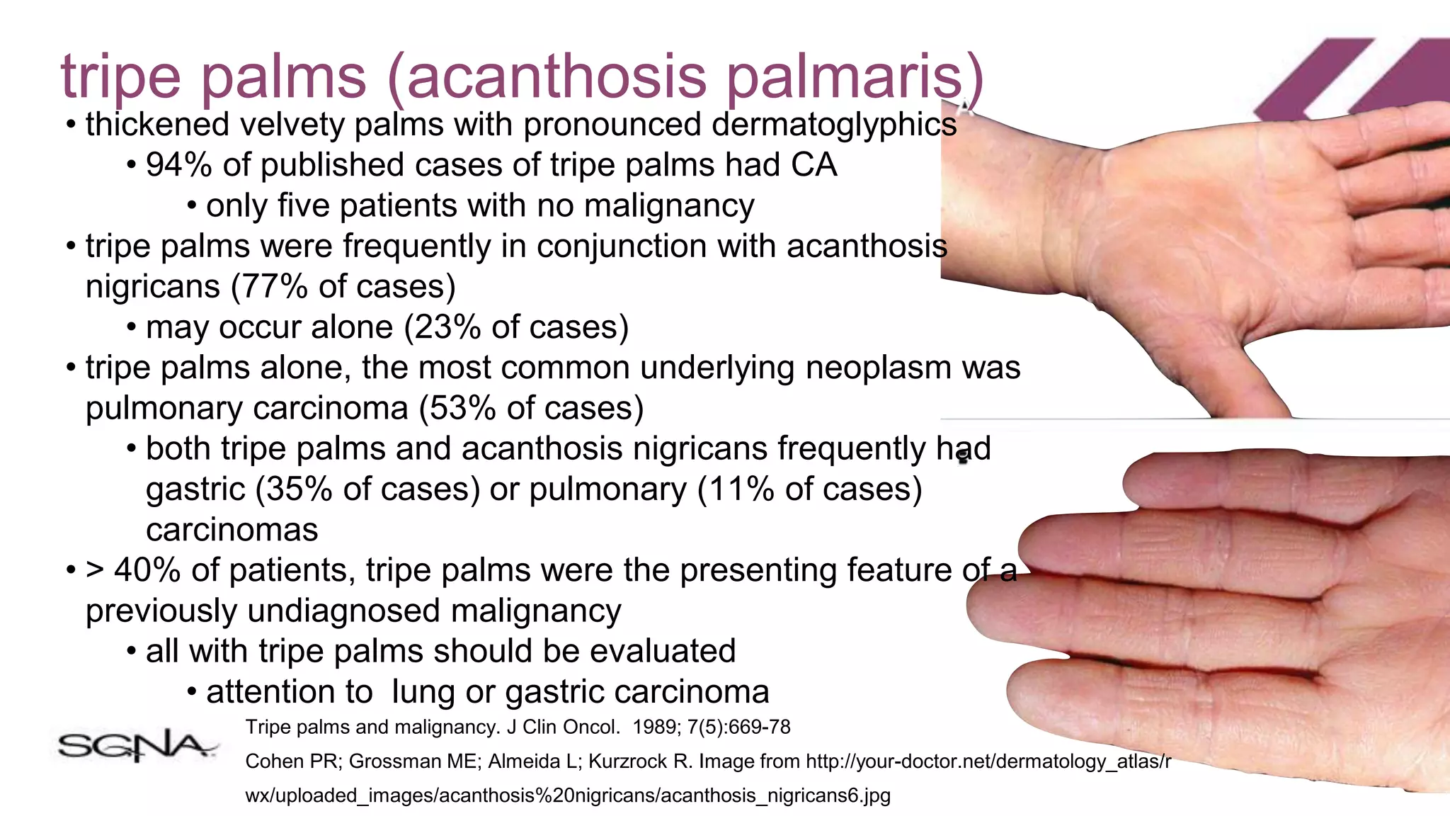 Know GI Inside & Out? Recognizing Skin Lesions of GI Disorders | PPTX