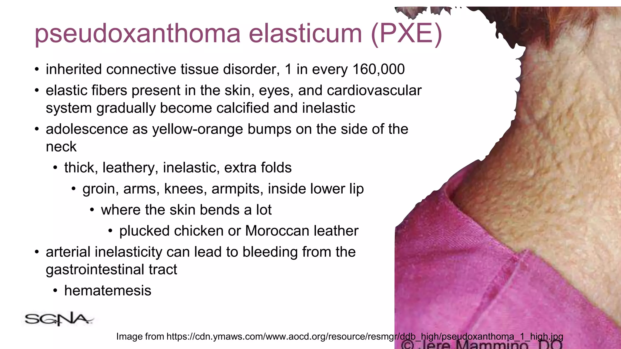 Know GI Inside & Out? Recognizing Skin Lesions of GI Disorders | PPTX