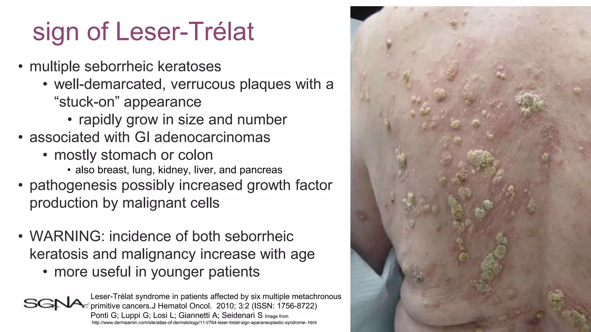 Know GI Inside & Out? Recognizing Skin Lesions of GI Disorders | PPTX