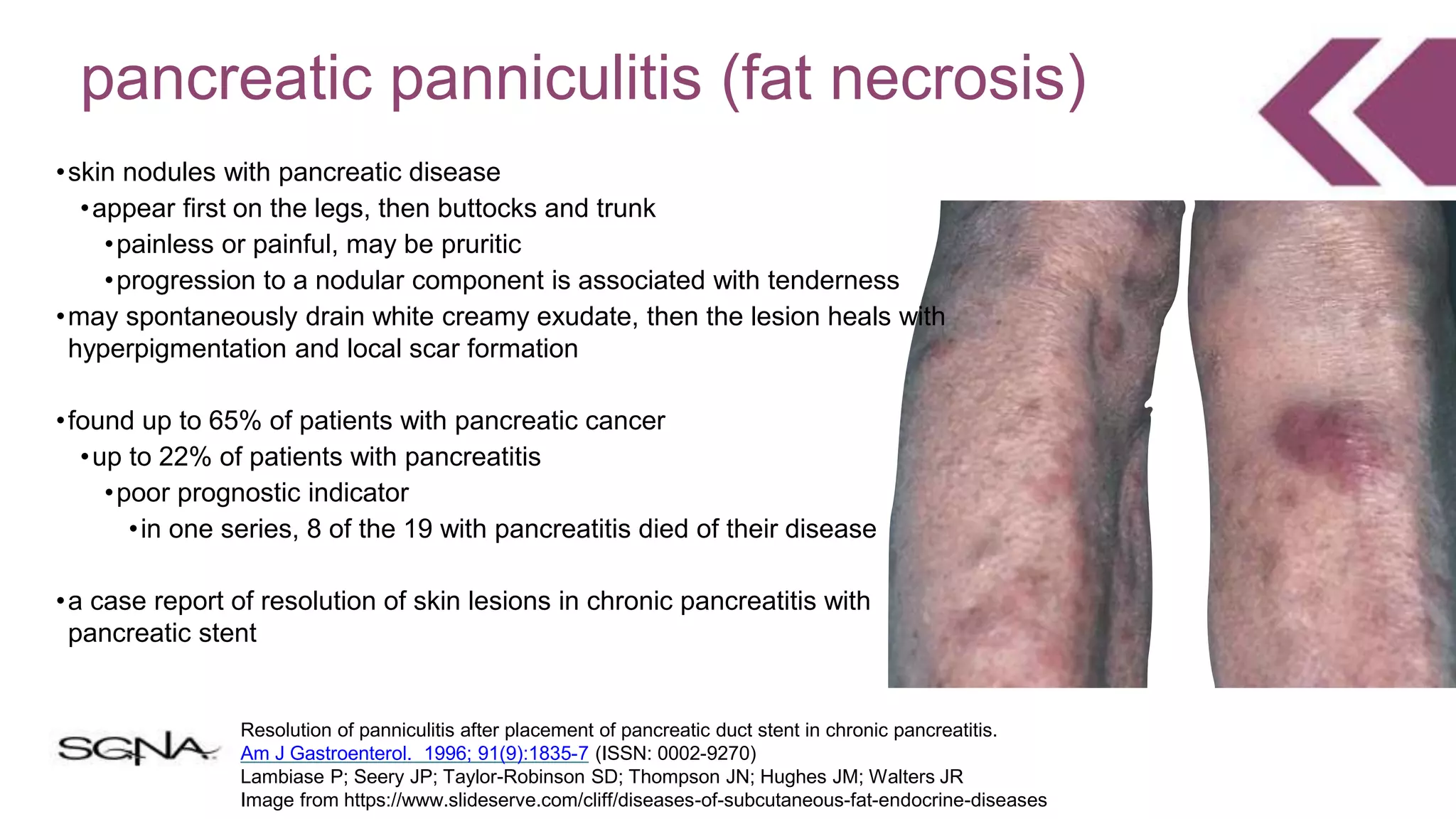 Know GI Inside & Out? Recognizing Skin Lesions of GI Disorders | PPTX