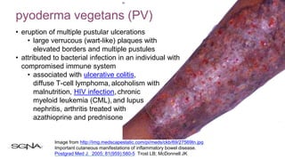 Know GI Inside & Out? Recognizing Skin Lesions of GI Disorders | PPTX