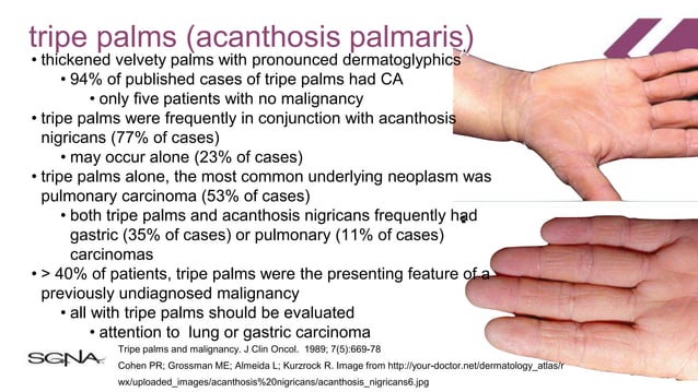 Know GI Inside & Out? Recognizing Skin Lesions of GI Disorders | PPT