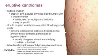 Know GI Inside & Out? Recognizing Skin Lesions of GI Disorders | PPT