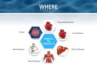 sgot and sgpt | PPTX