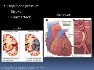 Final Sgp powerpoint | PPT