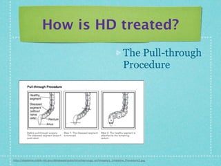 SGP PowerPoint (15 slides) | KEY