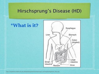 SGP PowerPoint (15 slides) | KEY