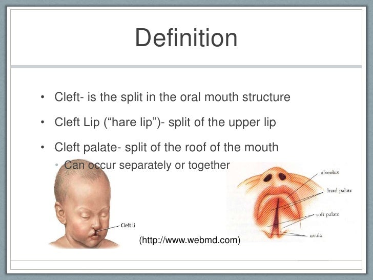 SGP-Cleft L/P