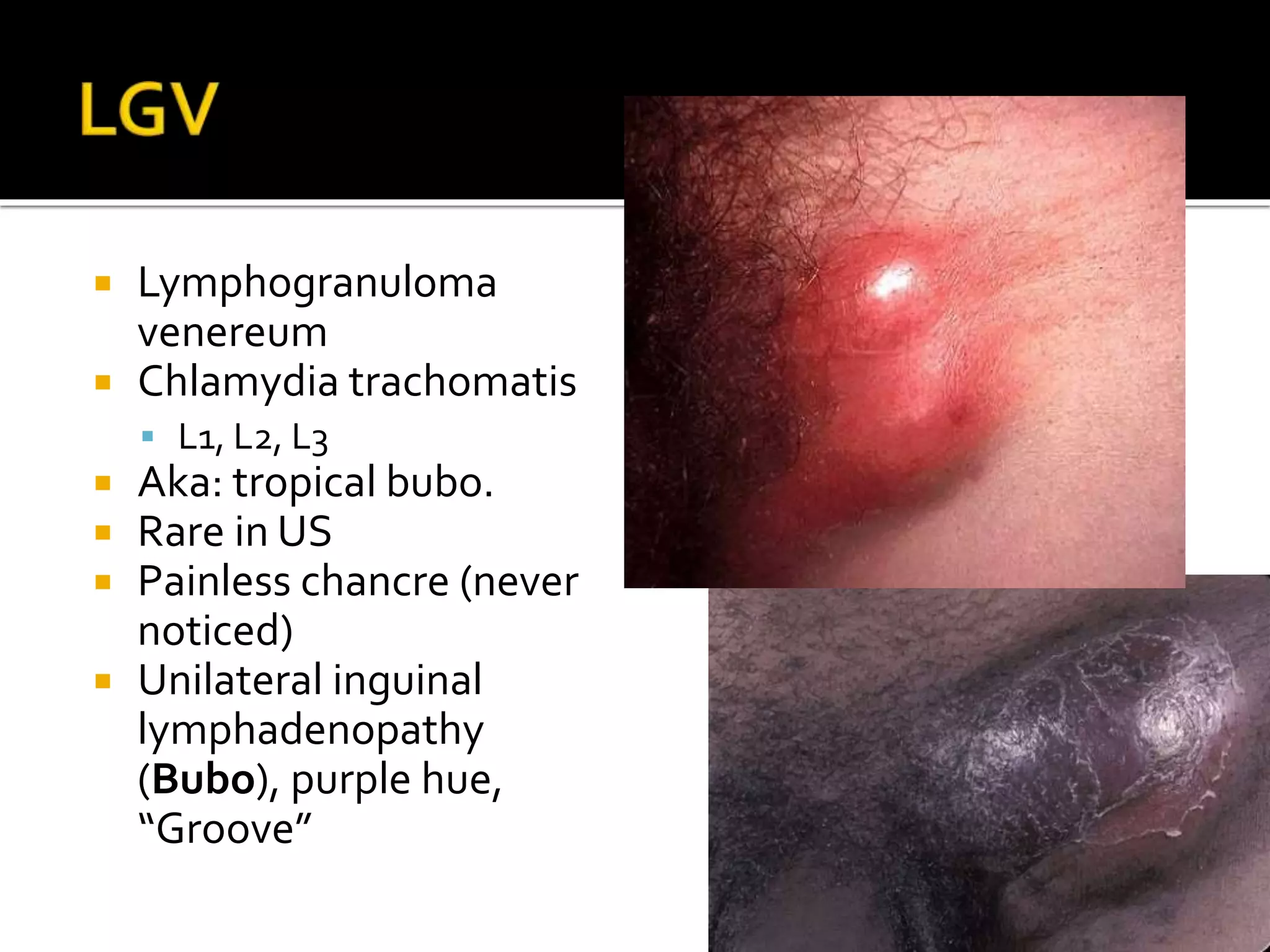 STDs - Dr. Mark Maynard | PPTX