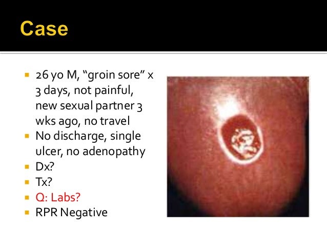 STDs - Dr. Mark Maynard