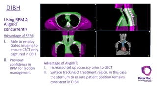 We Can See Clearly Now: Implementation of Surface Guided Radiation Therapy | PDF