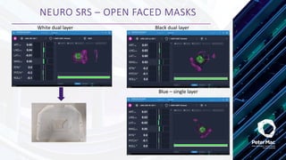 We Can See Clearly Now: Implementation of Surface Guided Radiation ...