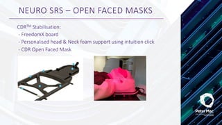 We Can See Clearly Now: Implementation of Surface Guided Radiation ...