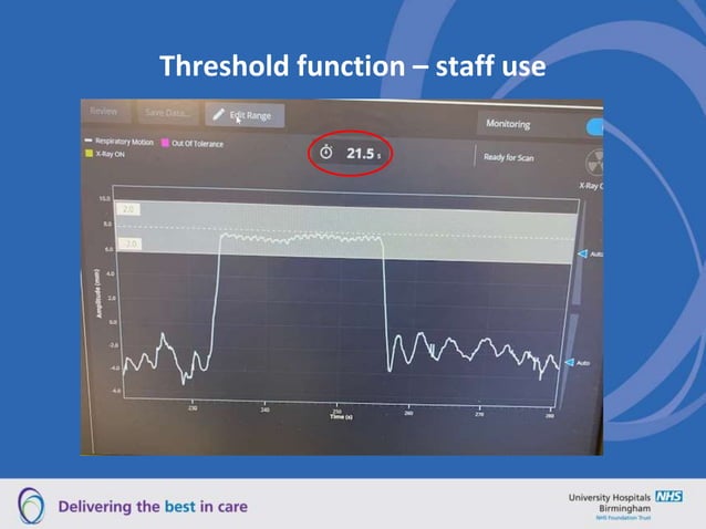 SimRT: Workflows and optimizing DIBH planning | PPTX