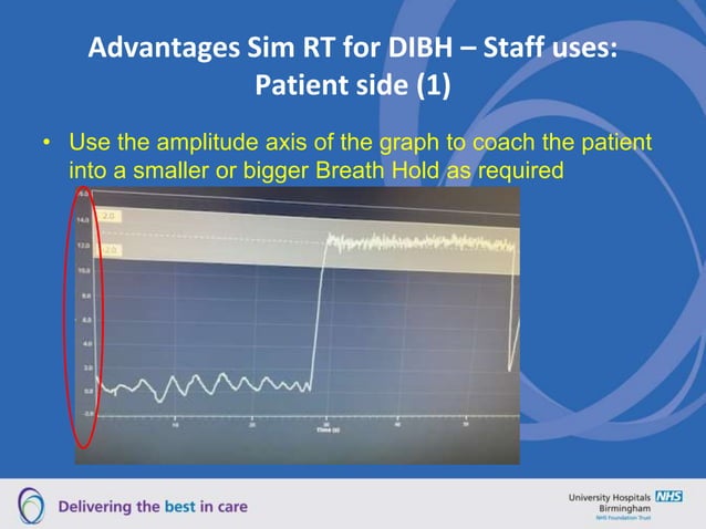 SimRT: Workflows and optimizing DIBH planning | PPTX