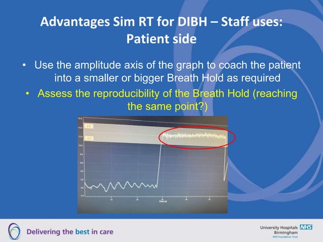 SimRT: Workflows and optimizing DIBH planning | PPTX
