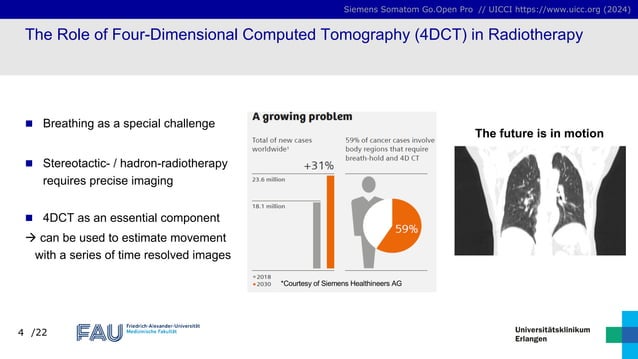 SGRT in Sim Usage of Surface Monitoring for Breathing-adapted Four ...