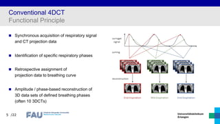 SGRT in Sim Usage of Surface Monitoring for Breathing-adapted Four-dimensional Computed ...