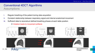 SGRT in Sim Usage of Surface Monitoring for Breathing-adapted Four ...