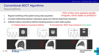 SGRT in Sim Usage of Surface Monitoring for Breathing-adapted Four-dimensional Computed ...