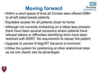 SGRT for DIBH: from zero to hero | PDF