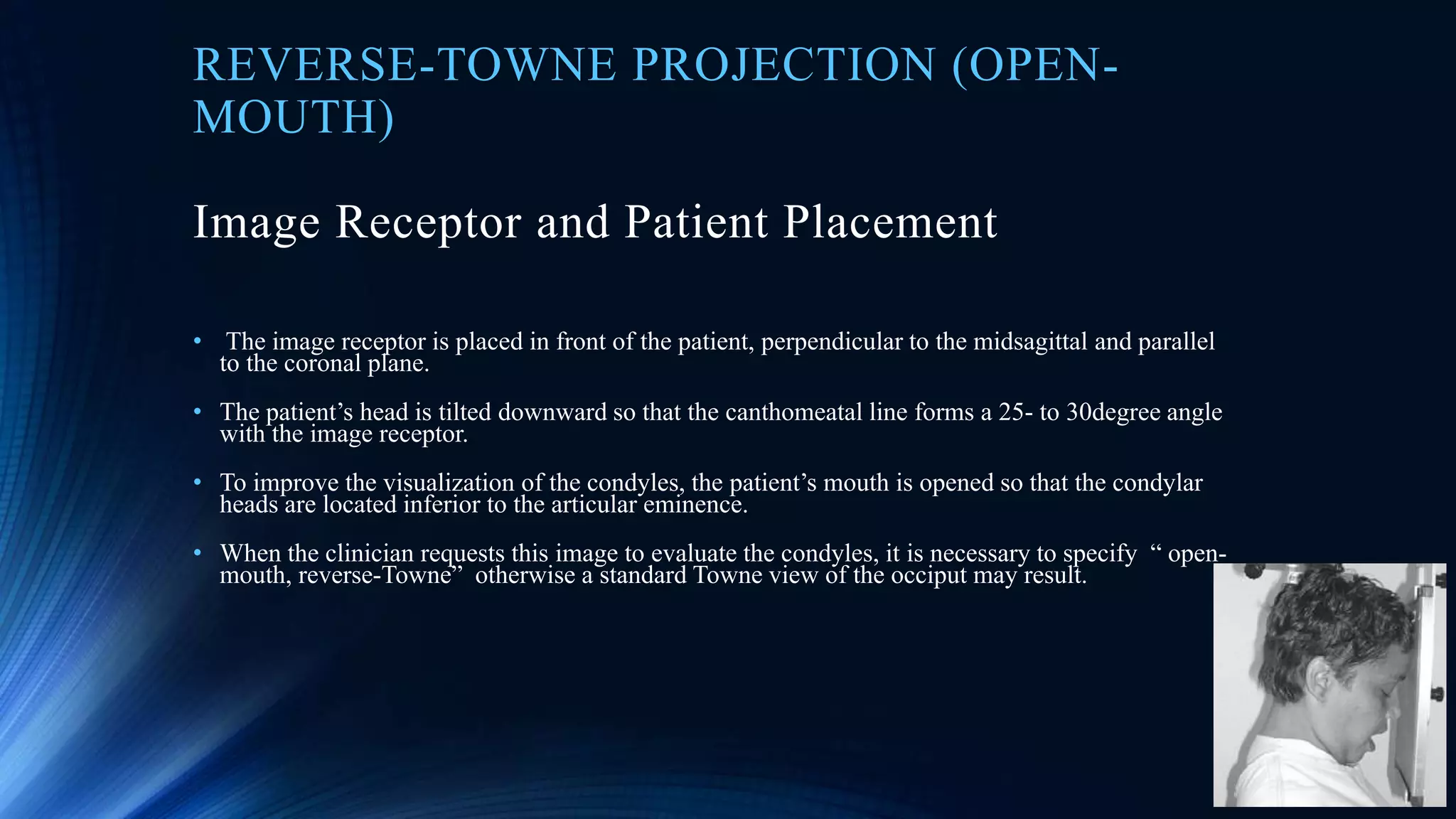 Extraoral Imaging Techniques | PPTX