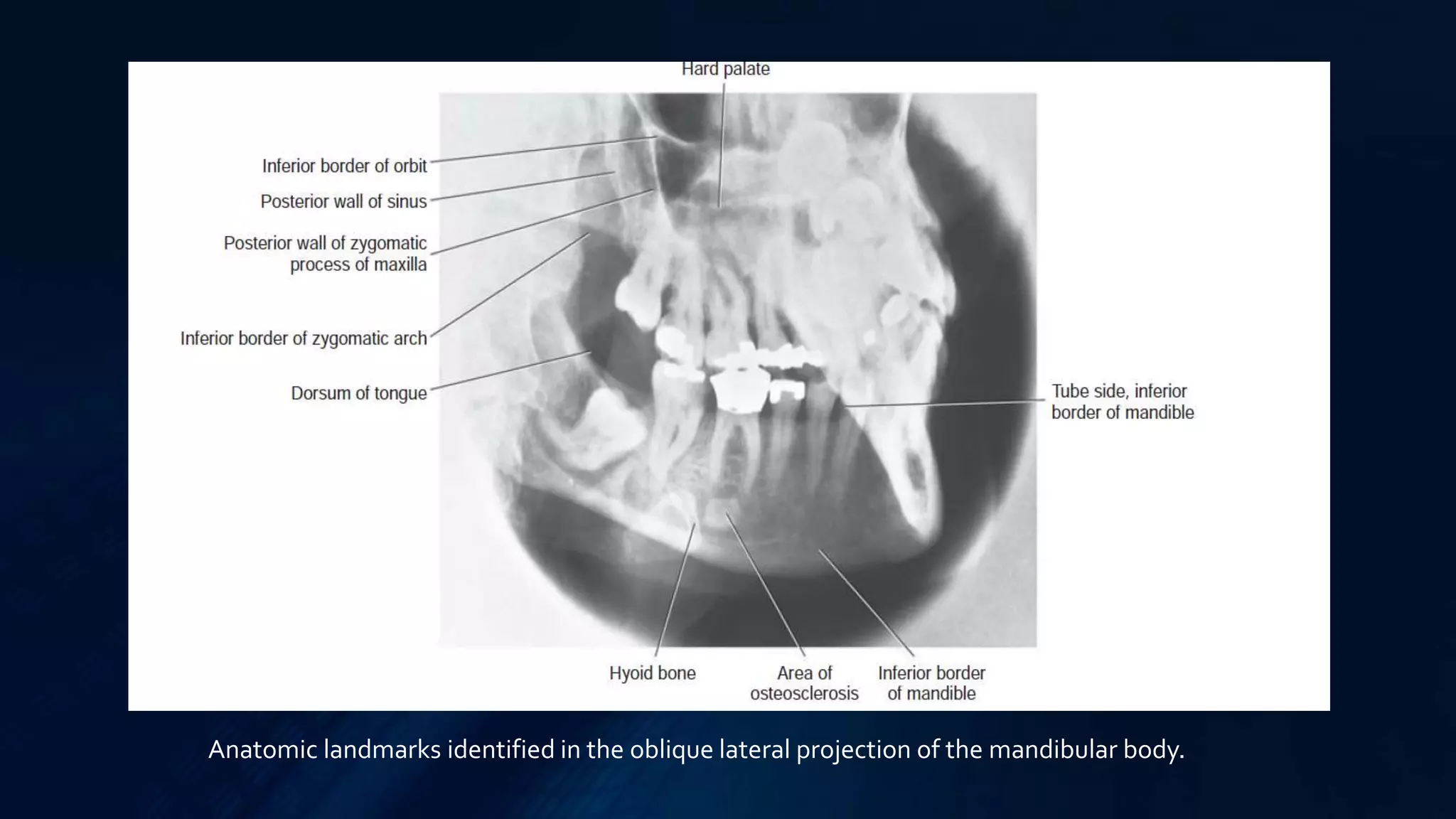 Extraoral Imaging Techniques | PPTX