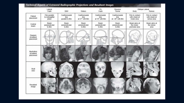 Extraoral Imaging Techniques | PPTX | Dental Health | Diseases and ...
