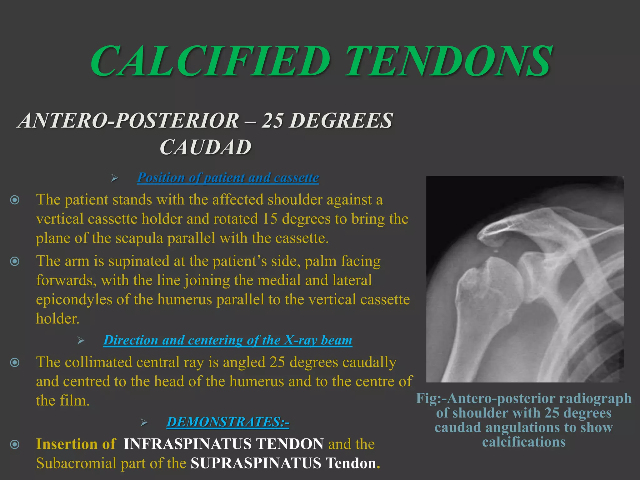 SHOULDER JOINT | PPTX