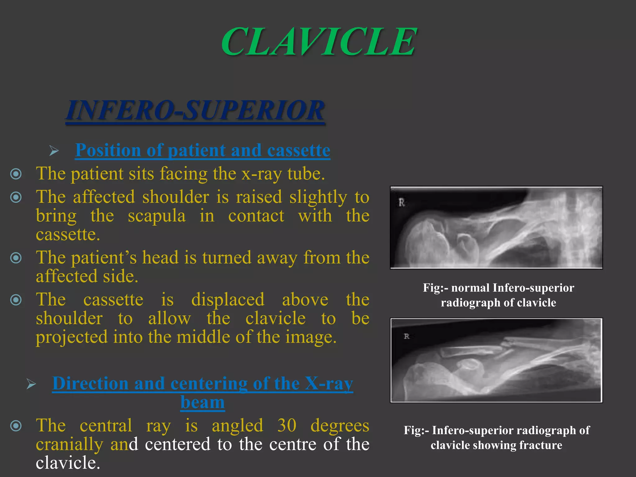 SHOULDER JOINT | PPTX
