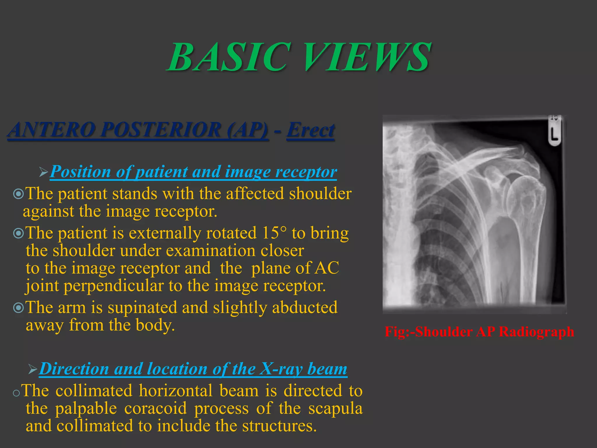 SHOULDER JOINT | PPTX