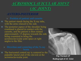 SHOULDER JOINT | PPTX