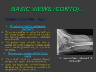 SHOULDER JOINT | PPTX